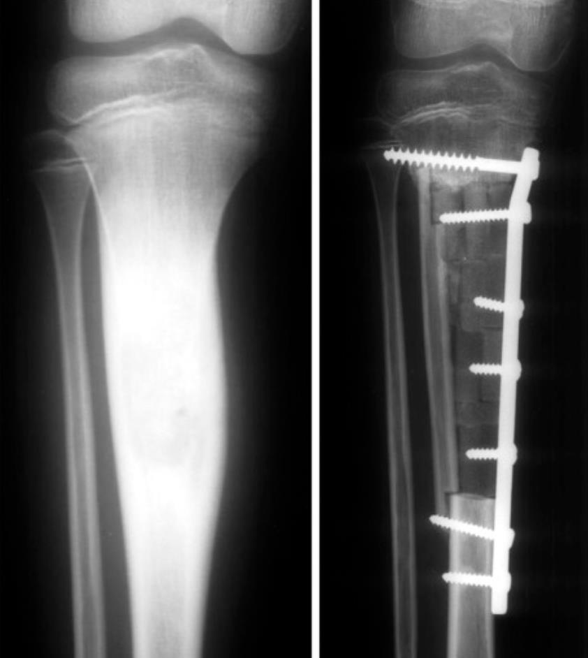 Question 212981 - Qbank - Orthobullets