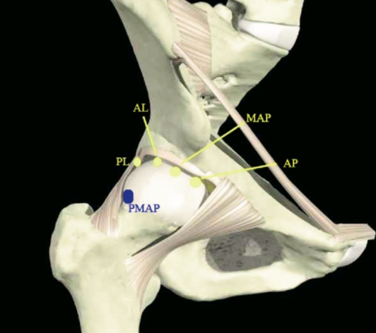 Question 213011 - Qbank - Orthobullets