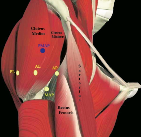 Question 213011 - Qbank - Orthobullets