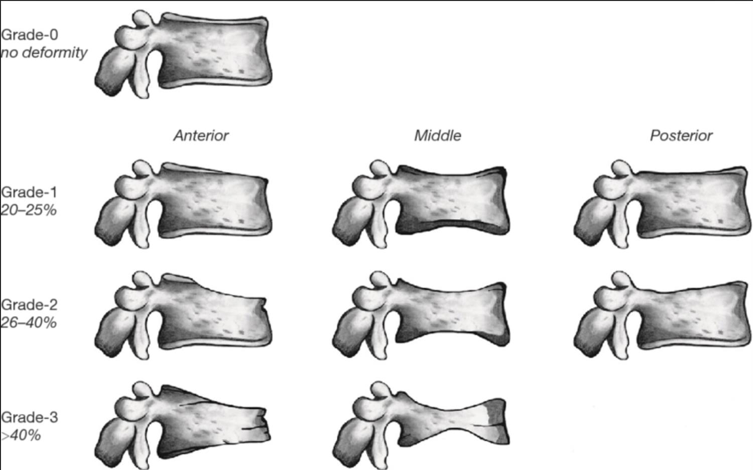 Question 213038 - Qbank - Orthobullets