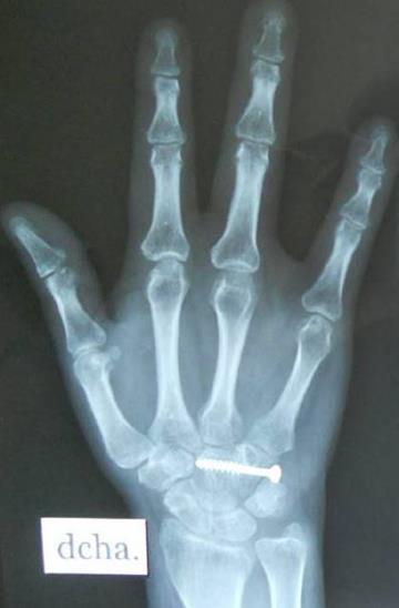 Question 213043 - Qbank - Orthobullets