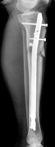 Question 213052 - Qbank - Orthobullets