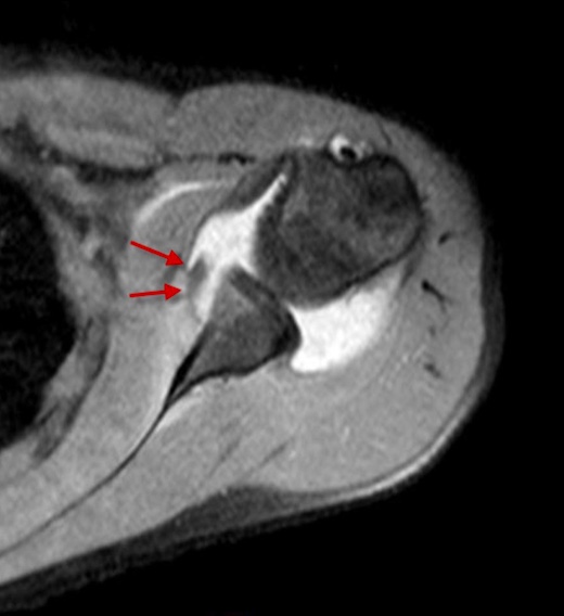 Question 213061 - Qbank - Orthobullets