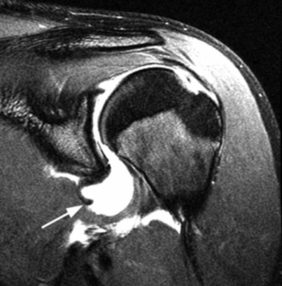 Question 213061 - Qbank - Orthobullets