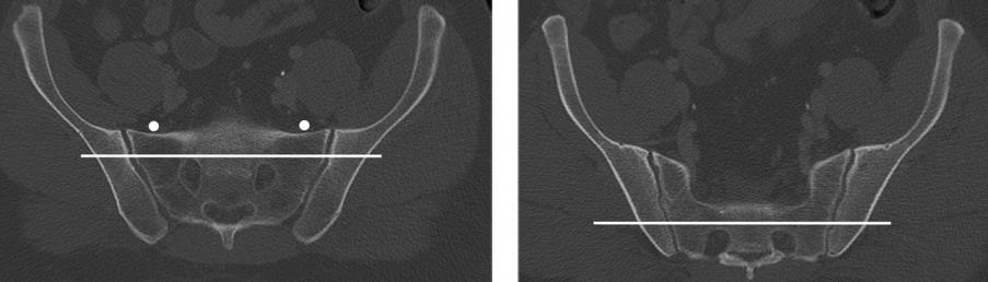 Question 213093 - Qbank - Orthobullets