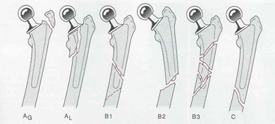Question 213117 - Qbank - Orthobullets