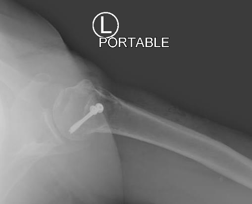 Question 213120 - Qbank - Orthobullets