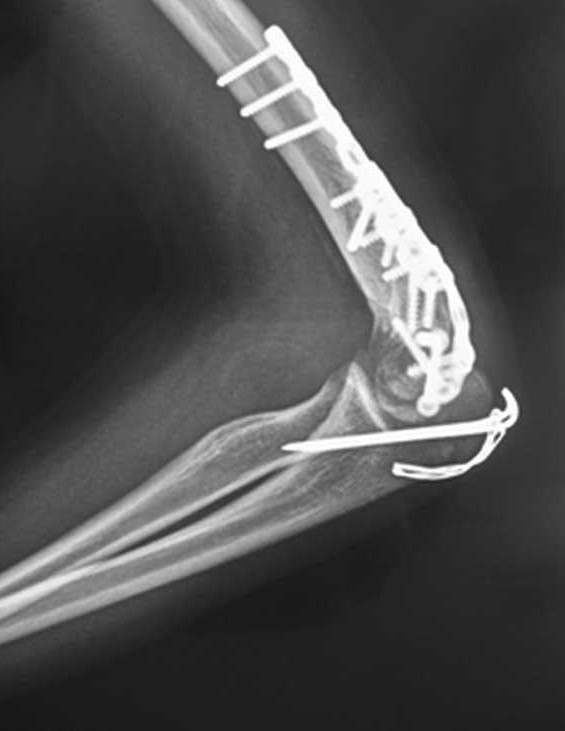 Question 213159 - Qbank - Orthobullets