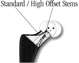 Question 213931 - Qbank - Orthobullets