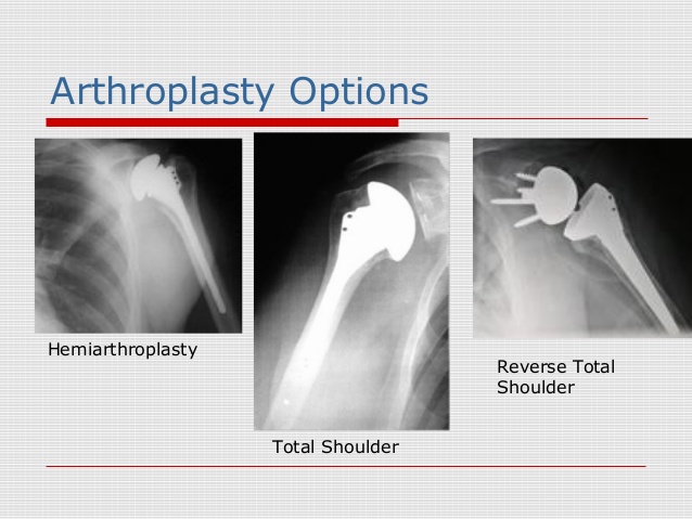 Question 213966 - Qbank - Orthobullets