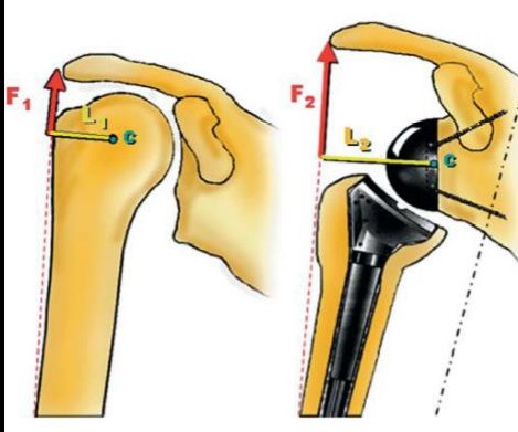 Question 213976 - Qbank - Orthobullets