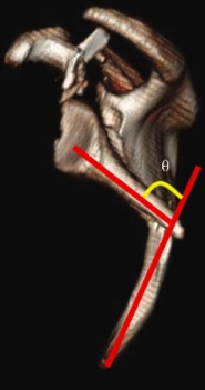 Question 214001 - Qbank - Orthobullets