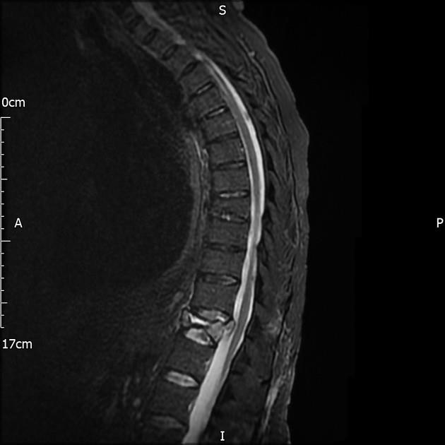 Question 214130 - Qbank - Orthobullets