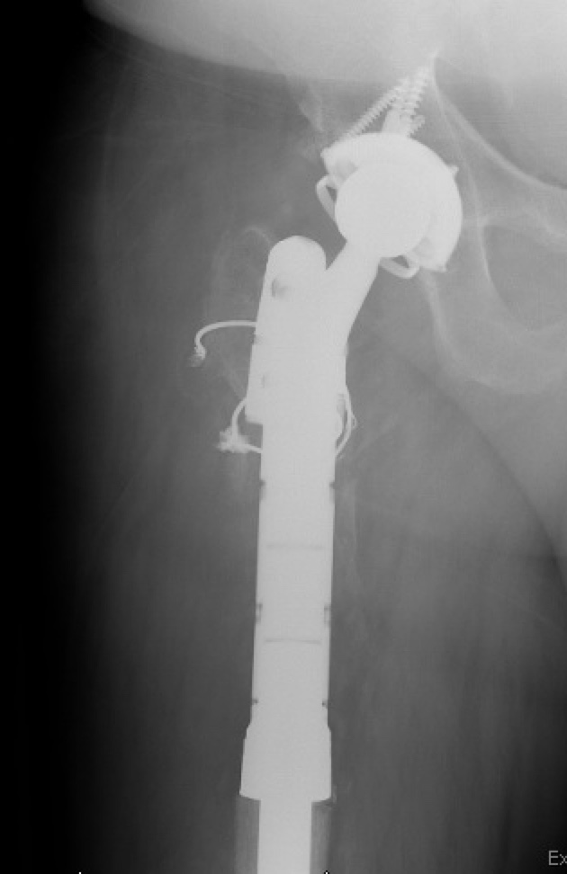 Question 214224 - Qbank - Orthobullets