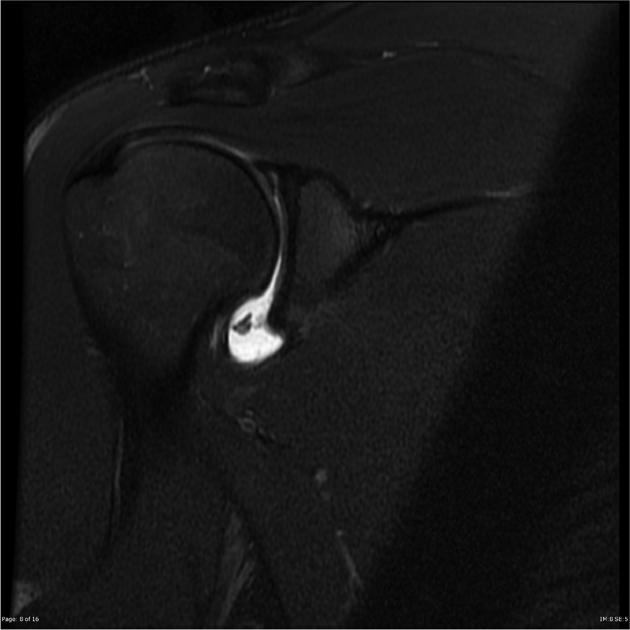 Question 214298 - Qbank - Orthobullets