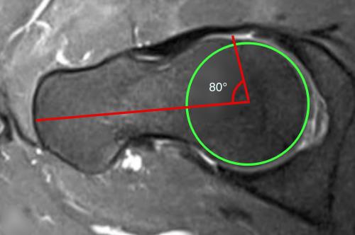 Question 214625 - Qbank - Orthobullets