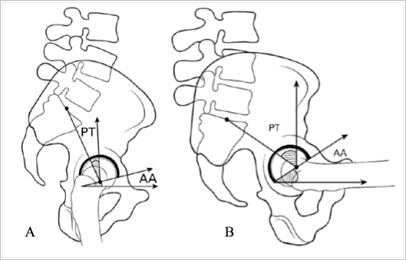 Question 215414 - Qbank - Orthobullets