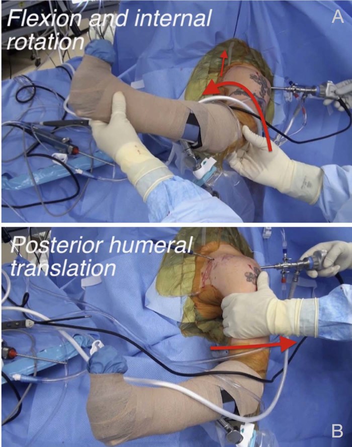 Question 215446 - Qbank - Orthobullets