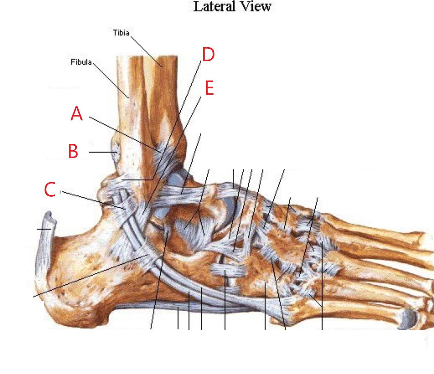 Prevalence of Peroneal Tendon Instability in Calcaneus Fractures: A ...