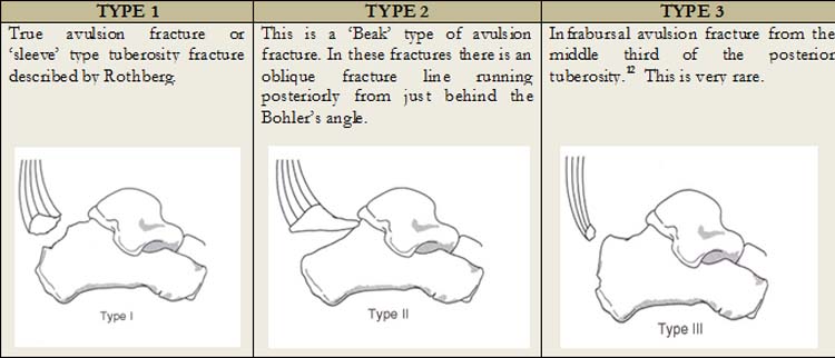 Question 215832 - Qbank - Orthobullets