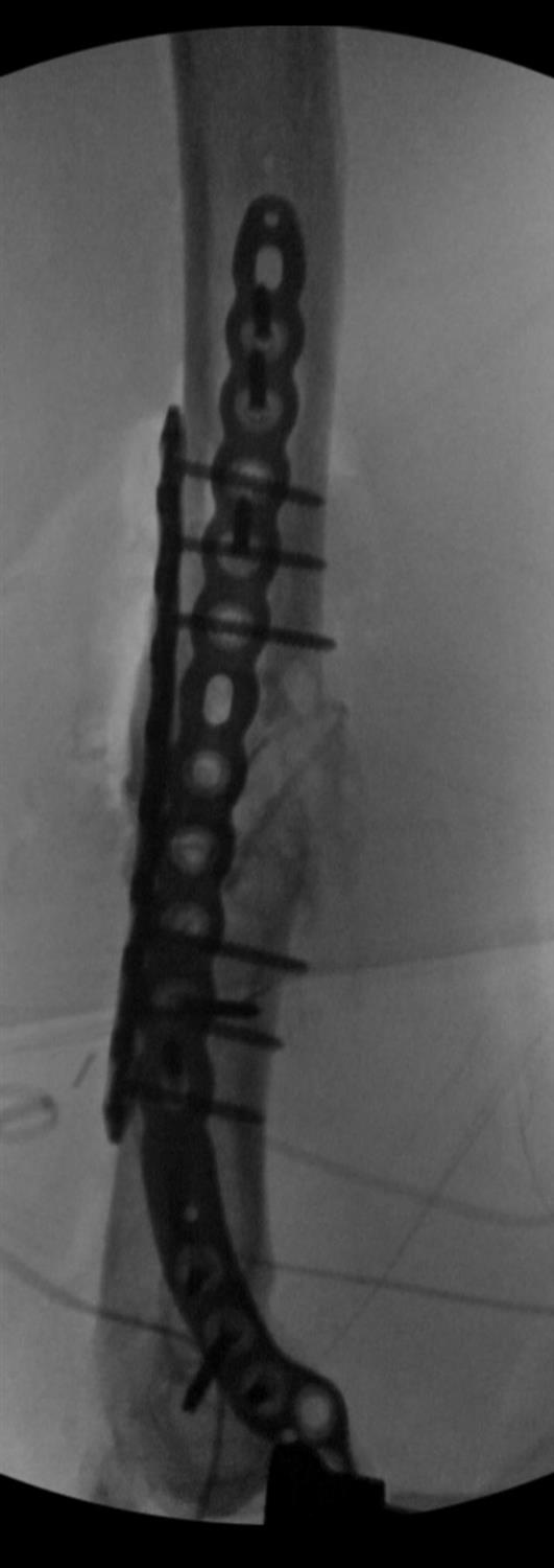 Question 216567 - Qbank - Orthobullets