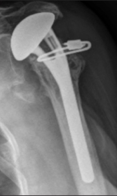 Question 216815 - Qbank - Orthobullets