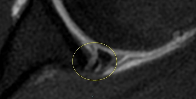 Question 216832 - Qbank - Orthobullets