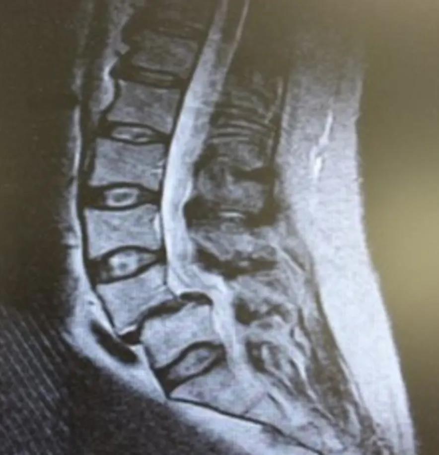 Question 217399 - Qbank - Orthobullets