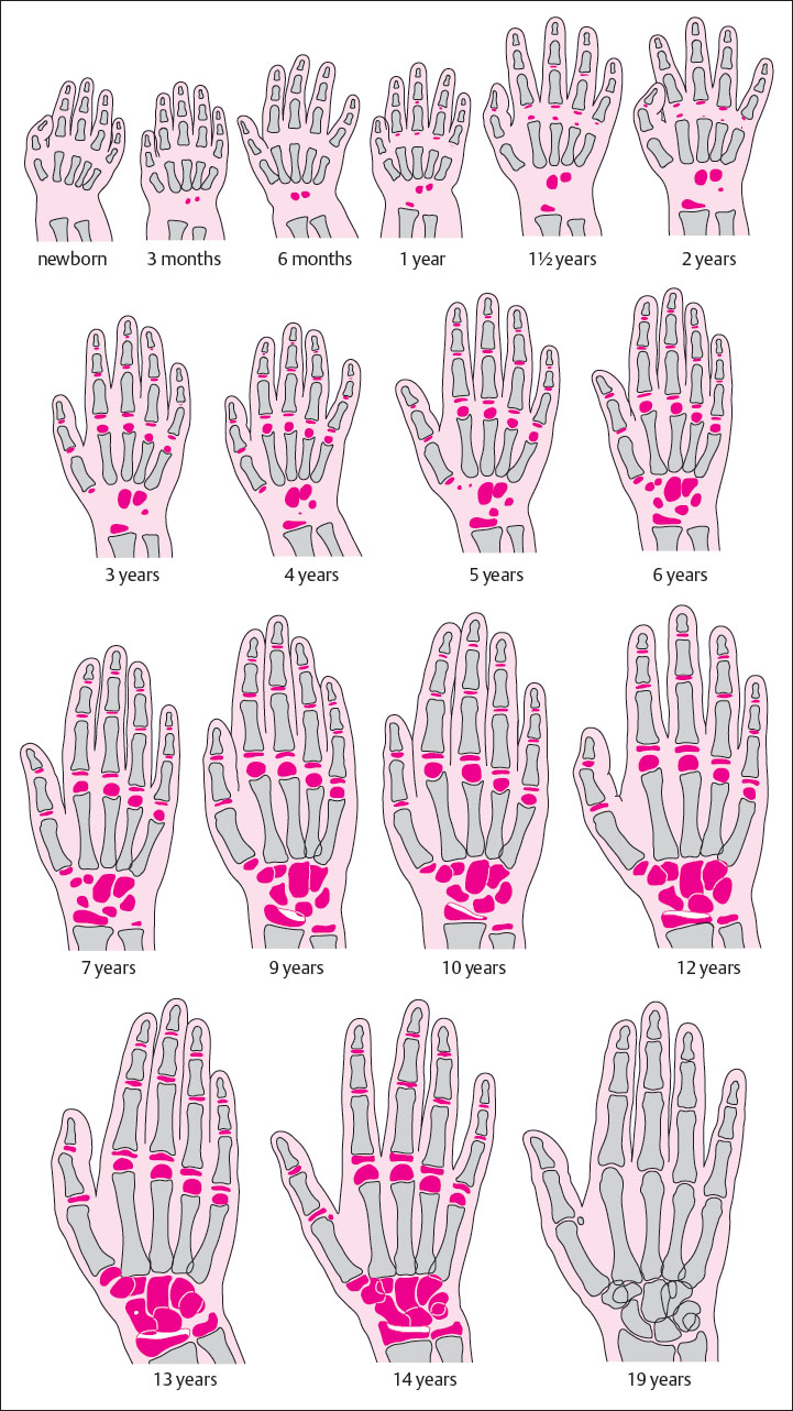 Question 217451 - Qbank - Orthobullets