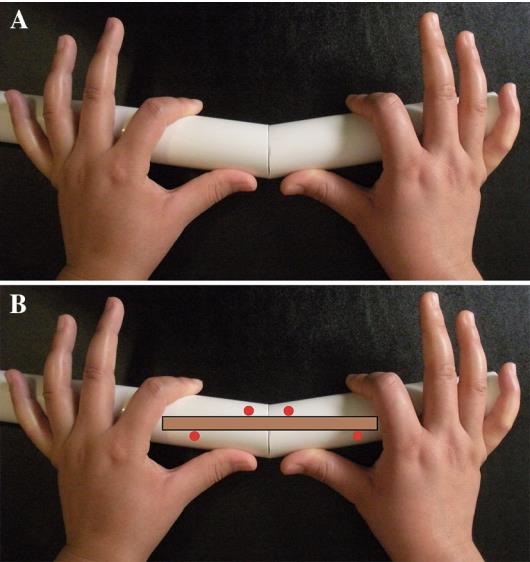 Question 217509 - Qbank - Orthobullets