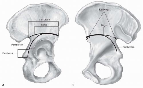Question 217814 - Qbank - Orthobullets