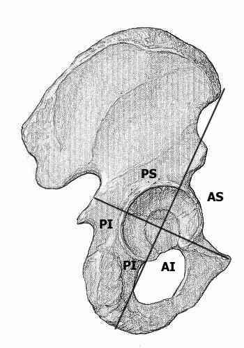 Question 217988 - Qbank - Orthobullets