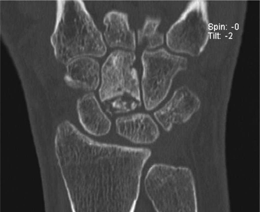 Question 217997 - Qbank - Orthobullets