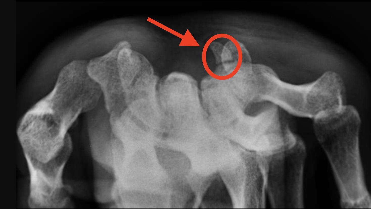 Question 218157 - Qbank - Orthobullets