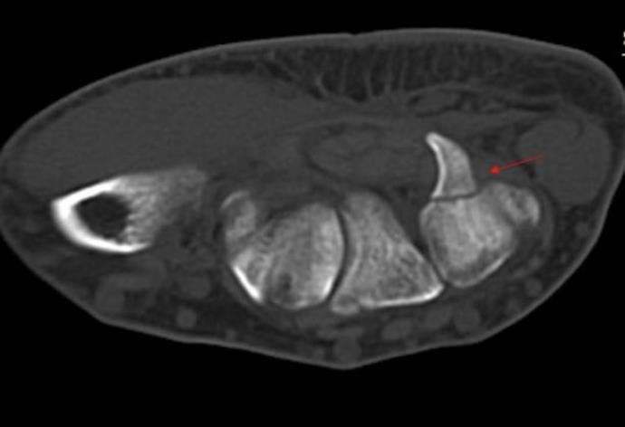 Question 218157 - Qbank - Orthobullets