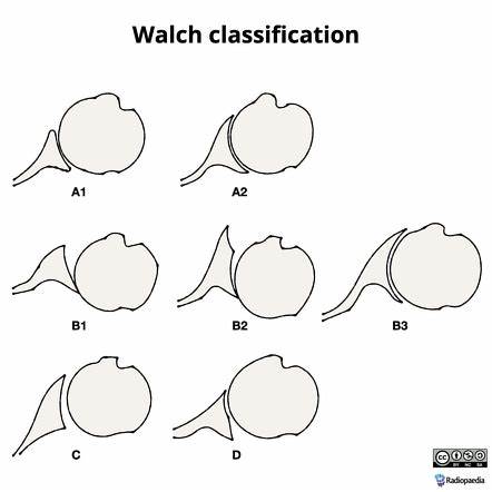 Question 218179 - Qbank - Orthobullets