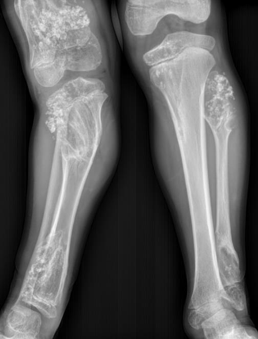 Question 218586 - Qbank - Orthobullets