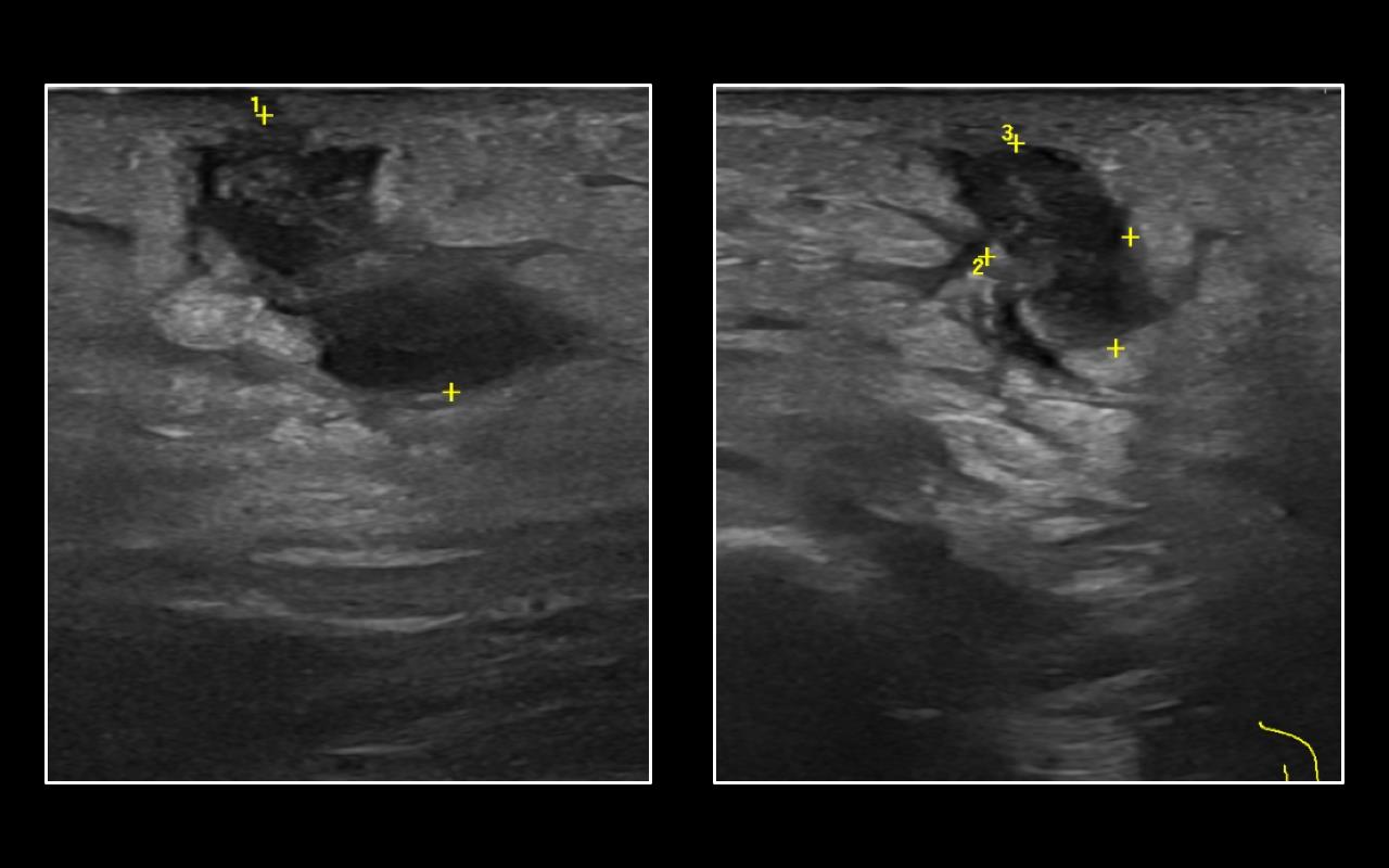 Question 218606 - Qbank - Orthobullets