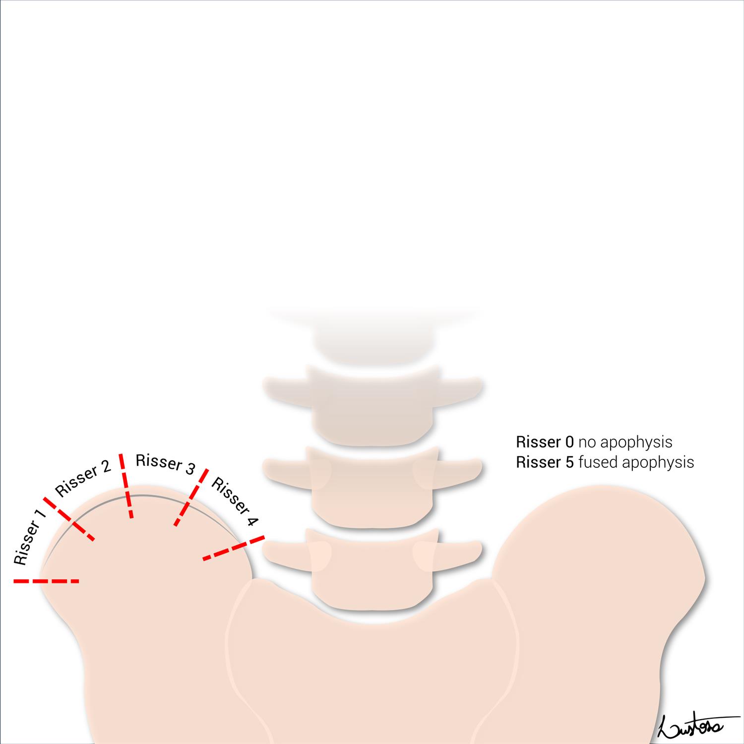 Question 218626 - Qbank - Orthobullets