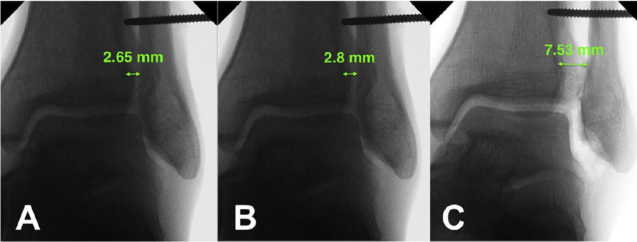 Question 218641 - Qbank - Orthobullets