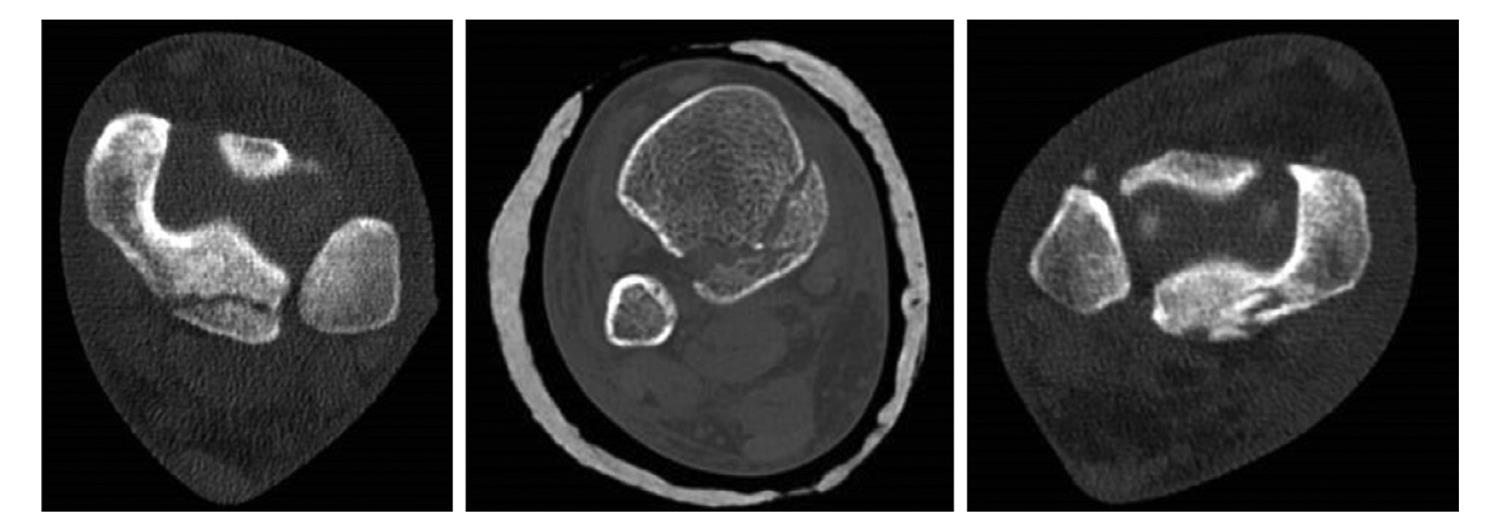 Question 218641 - Qbank - Orthobullets