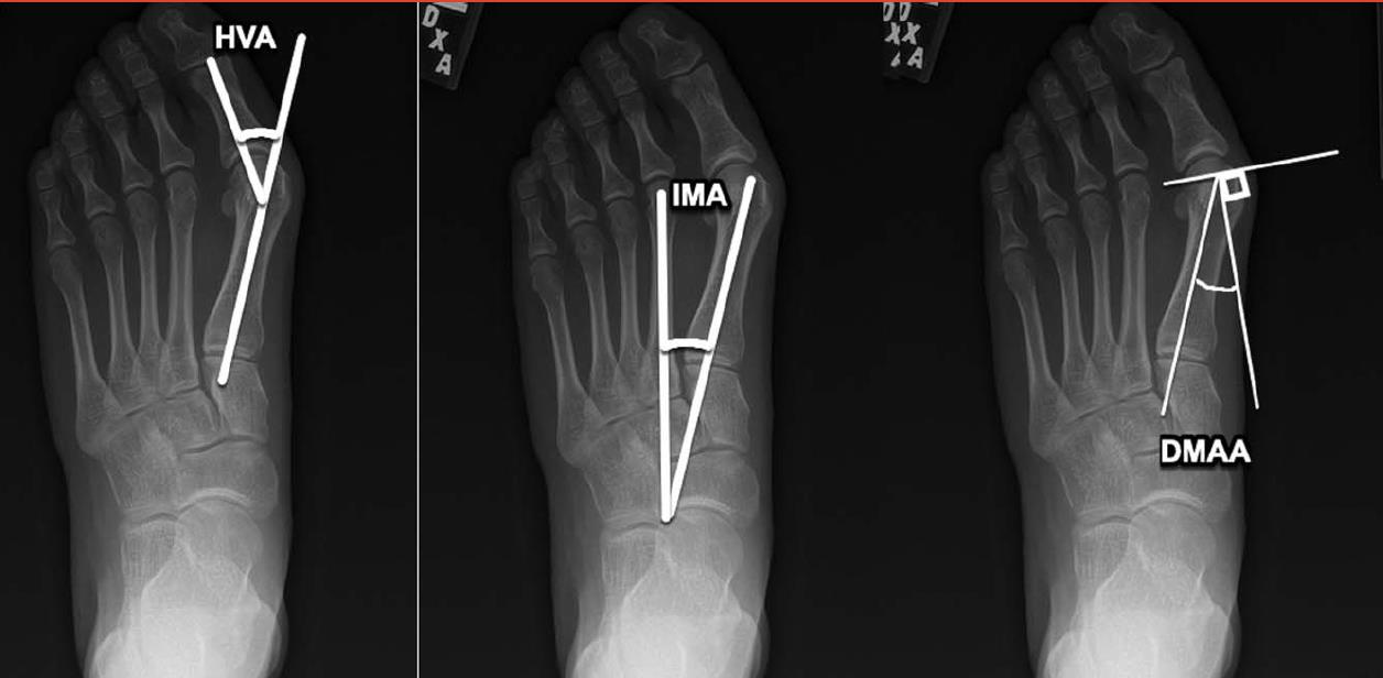Question 218645 - Qbank - Orthobullets