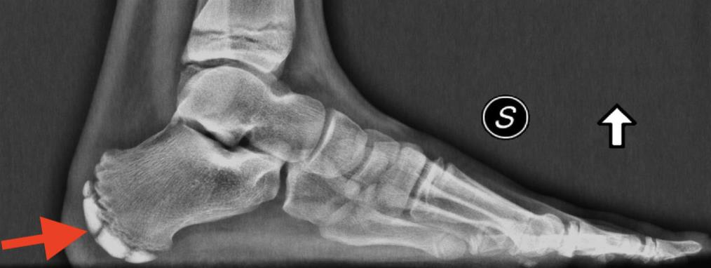Question 218684 - Qbank - Orthobullets