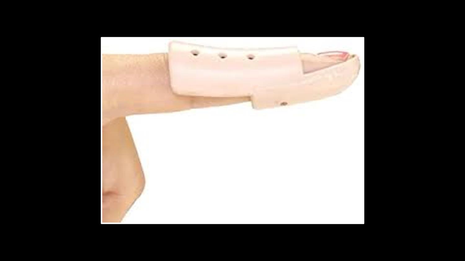 Question 218821 - Qbank - Orthobullets