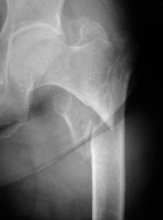 Question 218830 - Qbank - Orthobullets