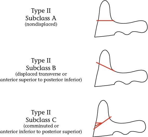 Question 218918 - Qbank - Orthobullets
