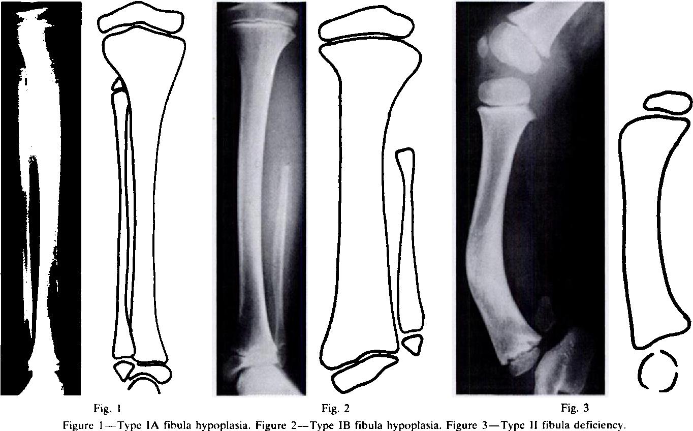 Question 218919 - Qbank - Orthobullets