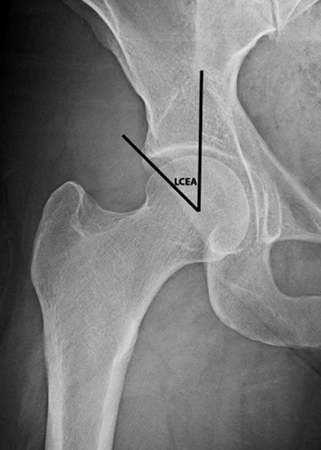 Question 218928 - Qbank - Orthobullets