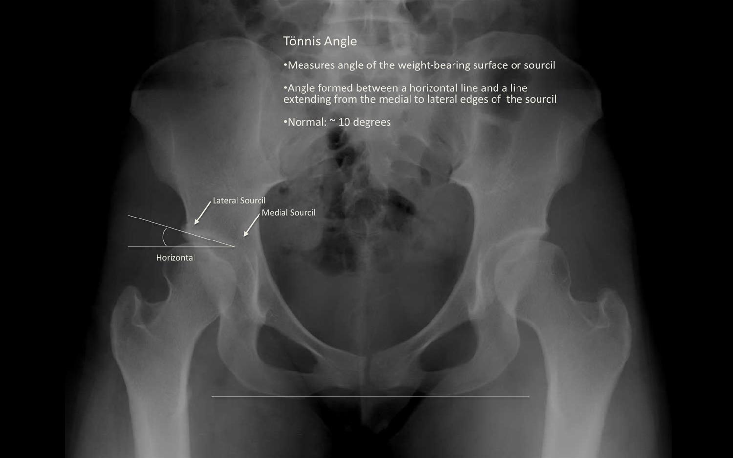 Question 218928 - Qbank - Orthobullets