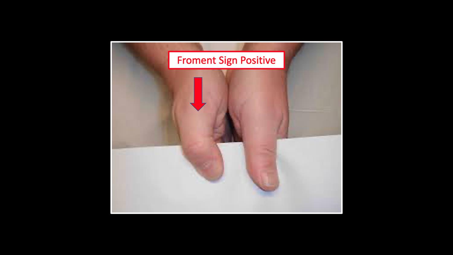 Question 218953 - Qbank - Orthobullets